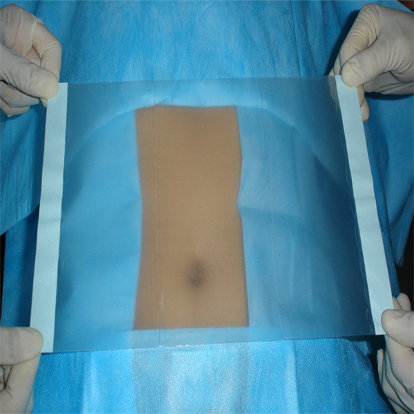 Sticky Surgical Incise Drapes Breathable Waterproof PE Coated Iodine Drape